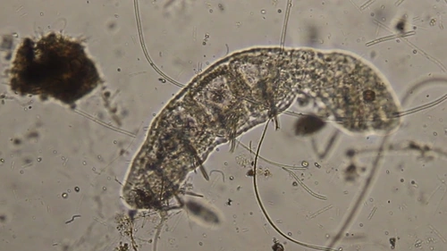 Chaetogaster limnaei | Animal Database | Fandom