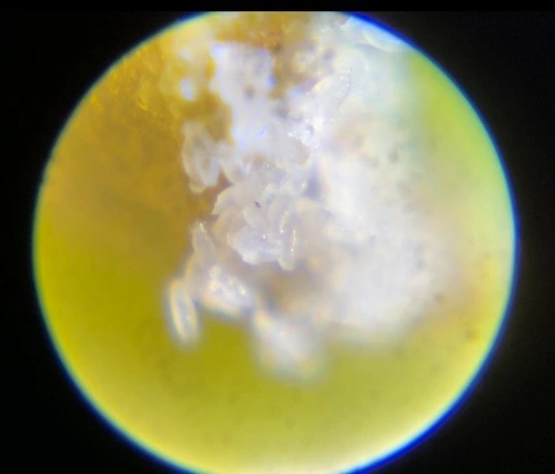 Almond and Plum Bud Gall Mite (Acalitus phloeocoptes) | Arachnipedia ...