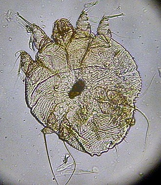 Itch Mite (Family Sarcoptidae) | Arachnipedia Wiki | Fandom