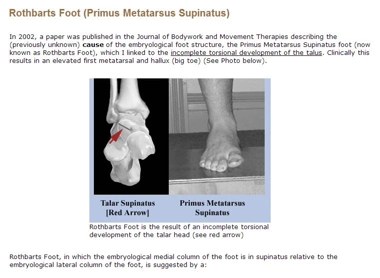 Pigeon-Toed (Intoeing) - Determining the Cause | Athlepedia, The ...