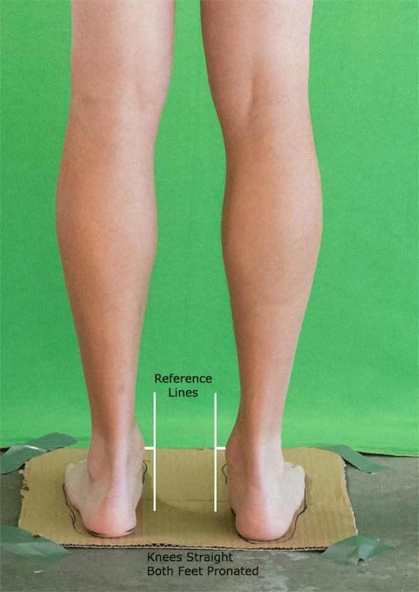 Pronation Test