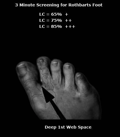 1st Web Space