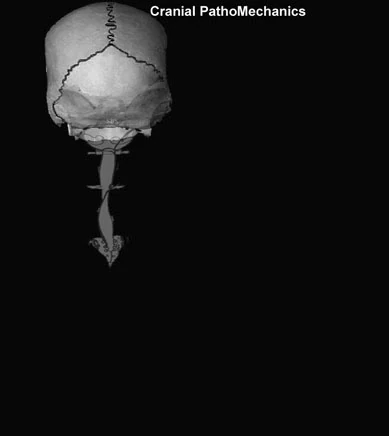 Short Leg Syndrome (aka Functional Leg Length Discrepancy) | Athlepedia ...