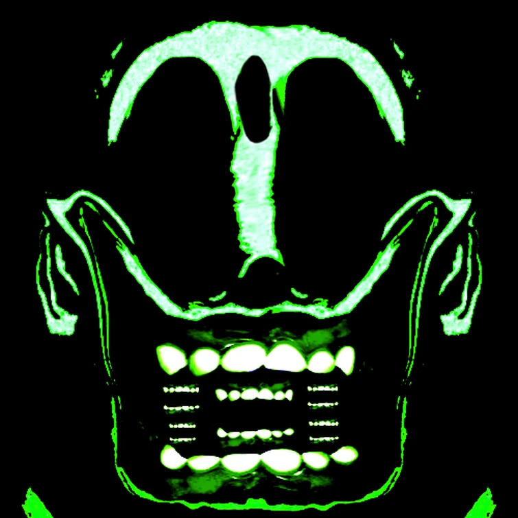 Phase 9 subphase + Phase 50 clone?? | Fandom