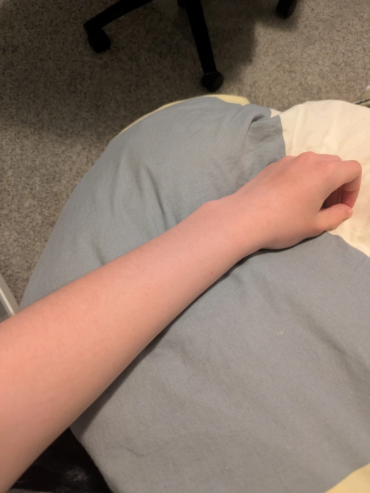 Early 2k posts arm reveal | Fandom