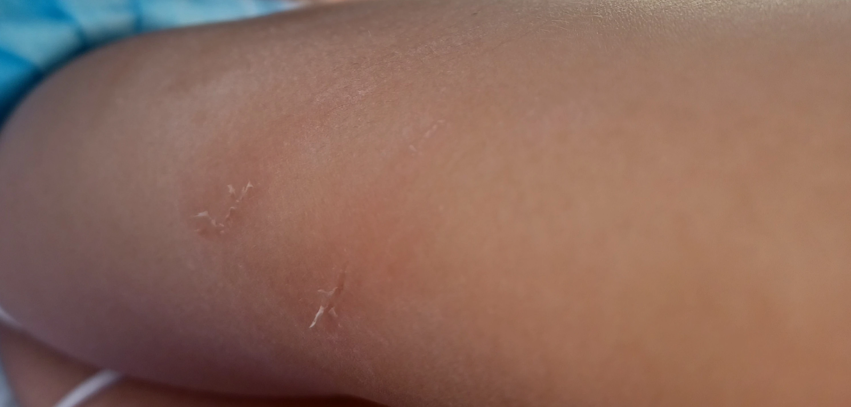 my friend grabbed my arm a little too hard | Fandom