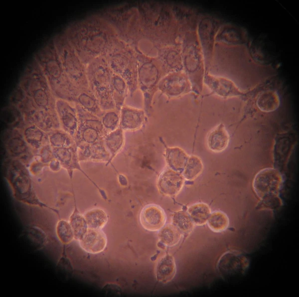 Entity Number: 19, The Disease | Backrooms Freewriting Wiki | Fandom