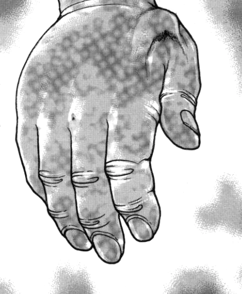 Poison Hand | Baki Wiki | Fandom