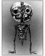 Bonesworth | Barli and SCP Foundation 2020 Wiki | Fandom