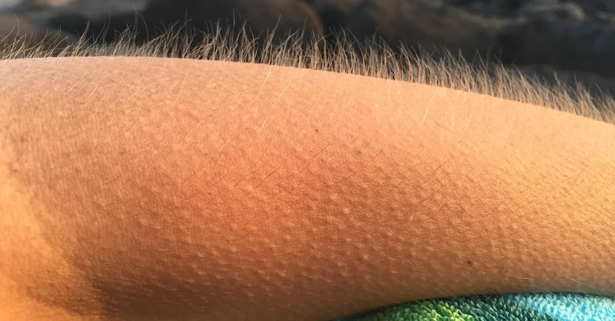 Shivers (Magic) | Bar Harbor Treasure Hunters Guild Wiki | Fandom