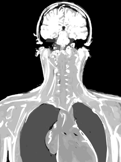 Body Scans | BrainPOP Wiki | Fandom