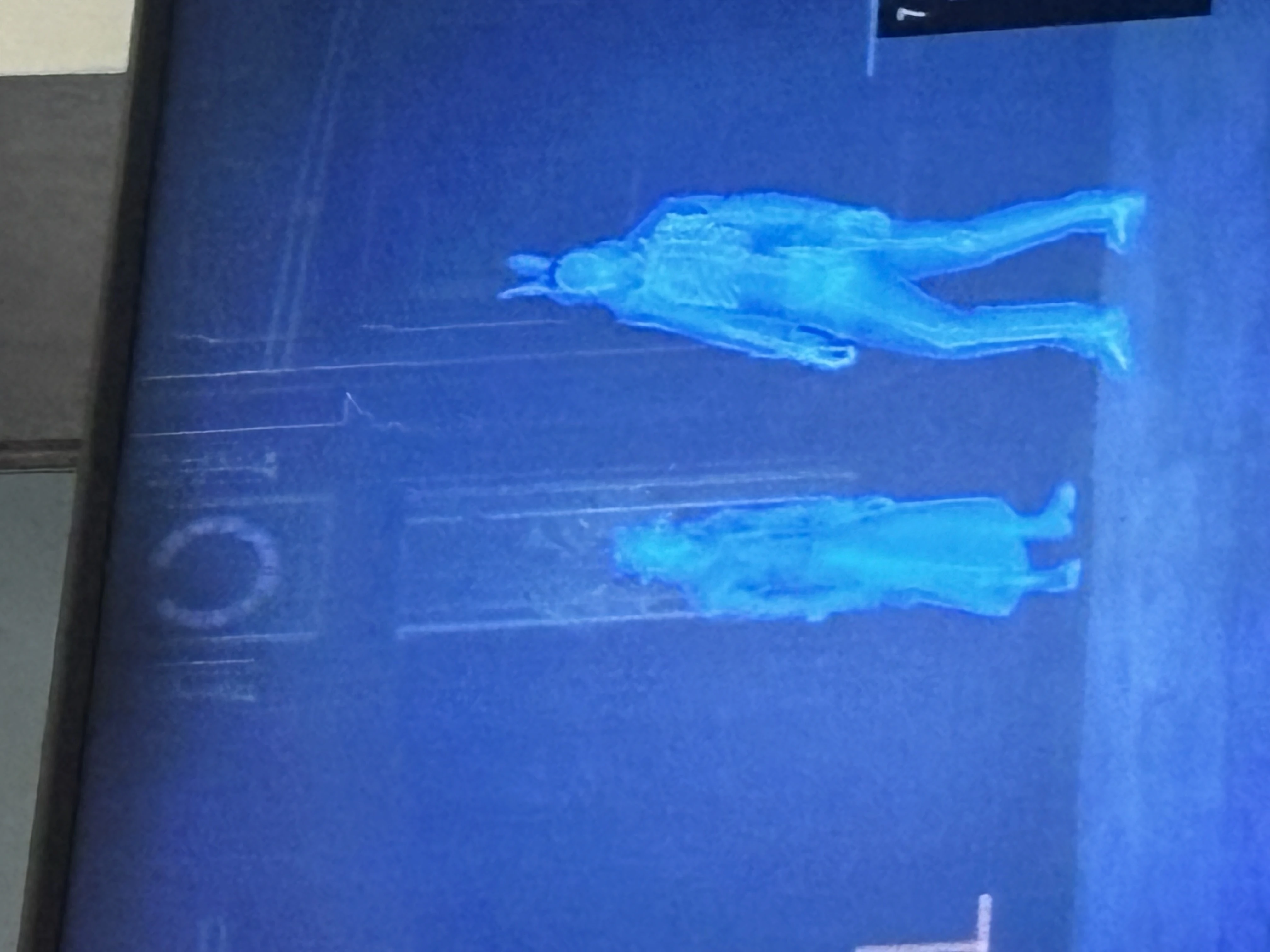 HE HAS NO BONES | Fandom