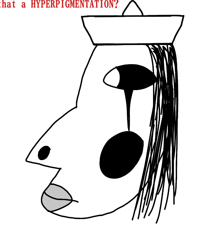 The mimic Hyperpigmentation meme | Fandom