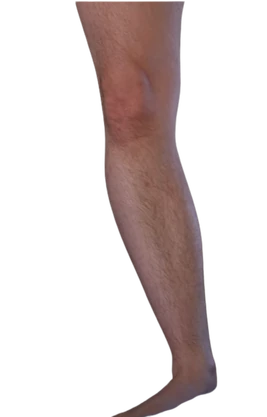 Leg | Caddicarus Wiki | Fandom
