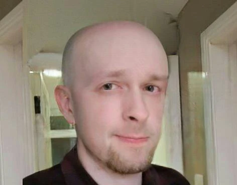 Bald | CallMeKevin Wiki | Fandom