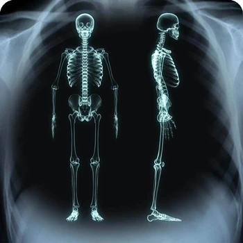 Skeleton | Cards, the Universe and Everything Wiki | Fandom