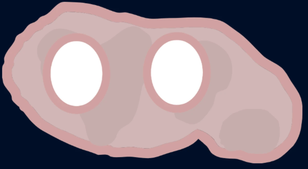 Metis | Celestialballs Wiki | Fandom