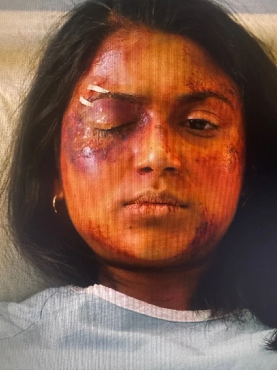 Vanessa Yeats | Chicago PD Wiki | Fandom