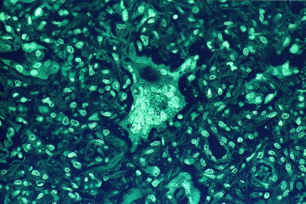 Lycan Virus | City of Sin Wiki | Fandom