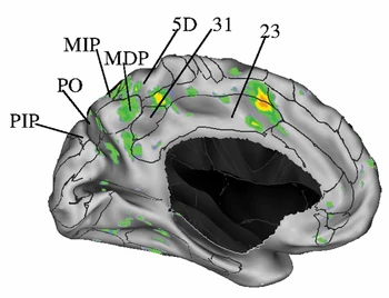 Medial intraparietal area | Classification Wiki | Fandom