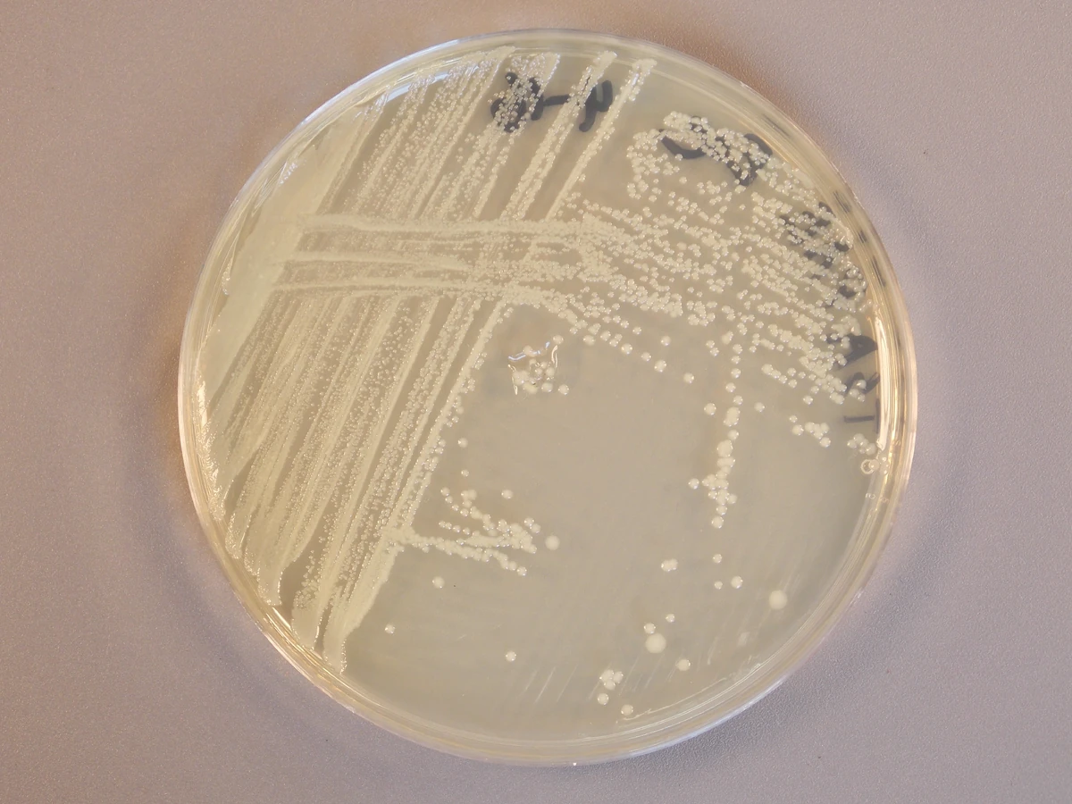 Enterobacter | Classroom Bacterial Identification Wiki | Fandom