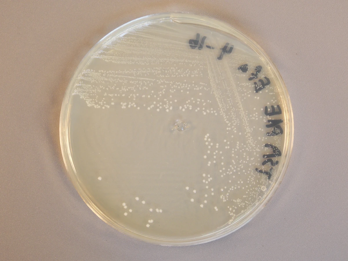 Enterococcus faecalis | Classroom Bacterial Identification Wiki | Fandom