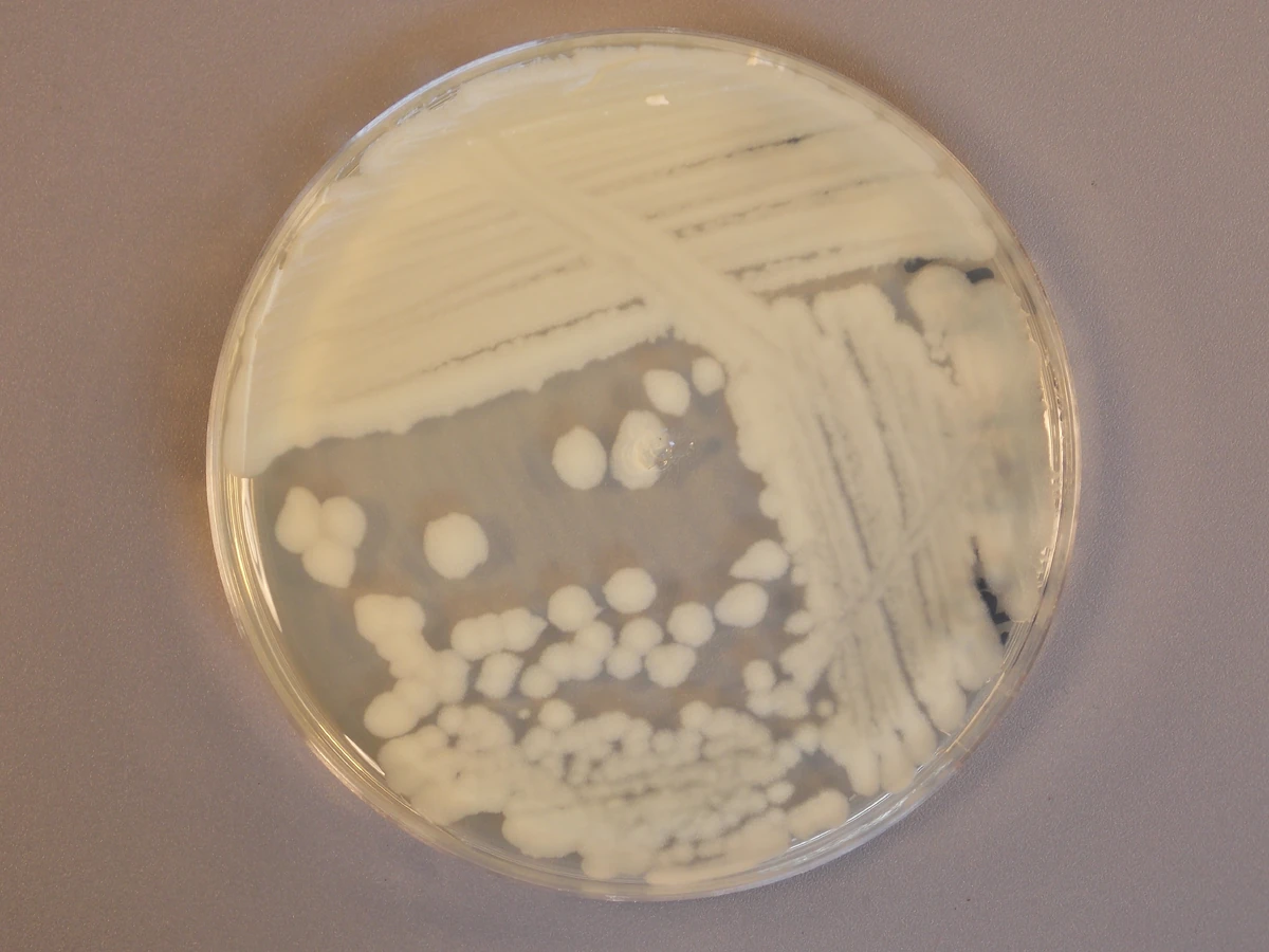 Bacillus | Classroom Bacterial Identification Wiki | Fandom