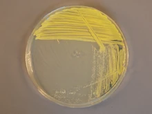 Micrococcus luteus | Classroom Bacterial Identification Wiki | Fandom