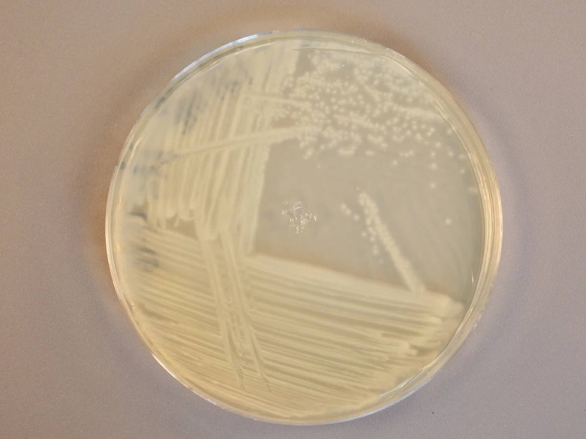 Alcaligenes faecalis | Classroom Bacterial Identification Wiki | Fandom