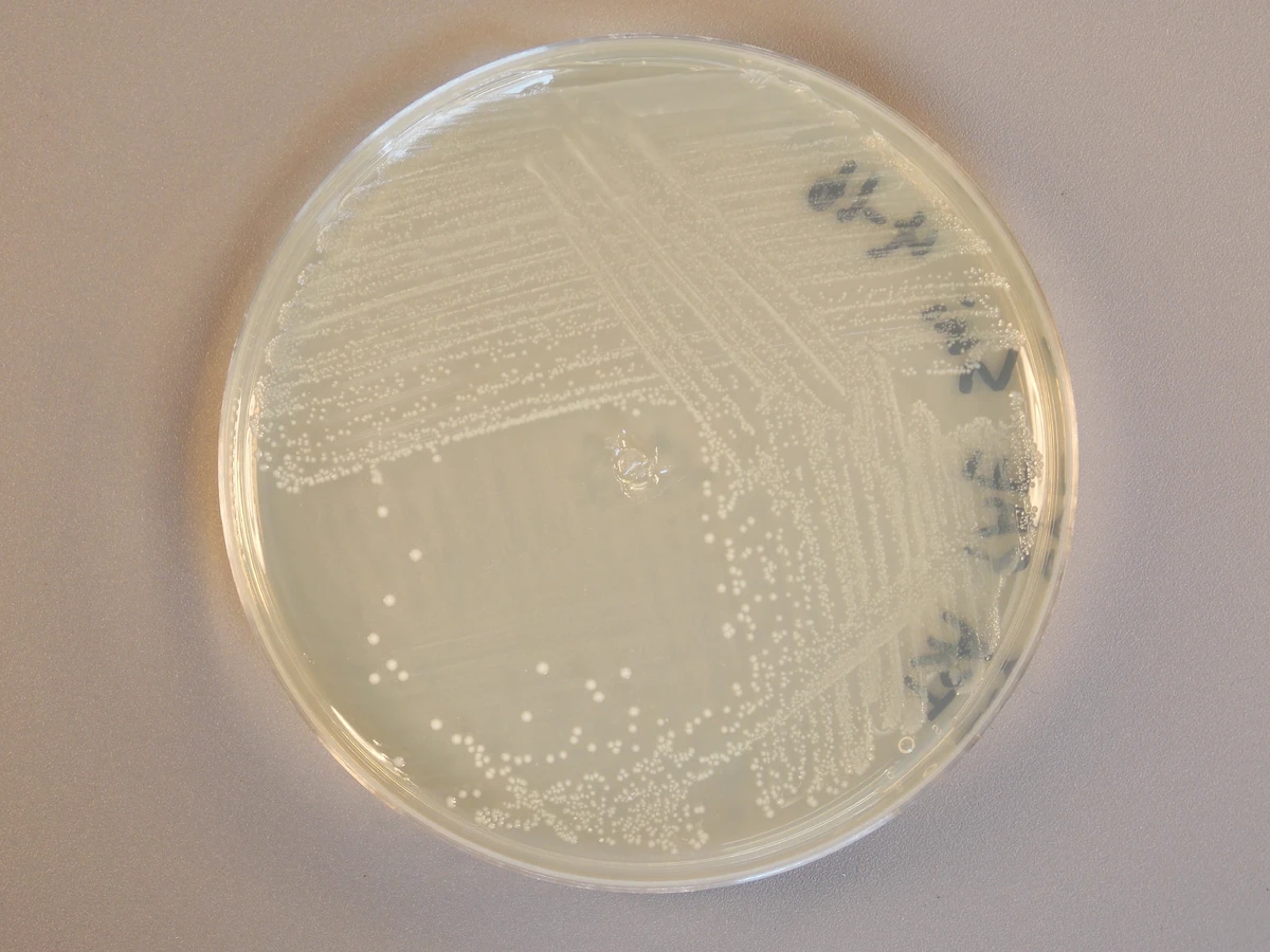 Streptococcus | Classroom Bacterial Identification Wiki | Fandom