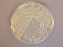 Citrobacter freundii | Classroom Bacterial Identification Wiki | Fandom