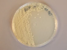 Proteus | Classroom Bacterial Identification Wiki | Fandom