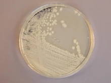 Salmonella | Classroom Bacterial Identification Wiki | Fandom
