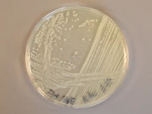 Klebsiella pneumonia | Classroom Bacterial Identification Wiki | Fandom