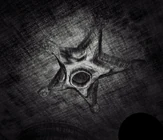 Starfish | Content Warning Wiki | Fandom