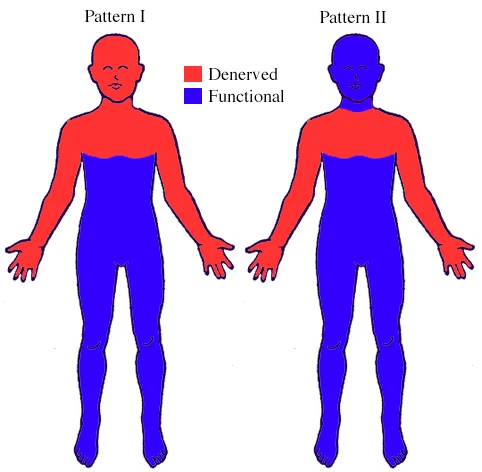 Changes to Individual Effectors, part 2 | Corposcindosis Wiki | Fandom