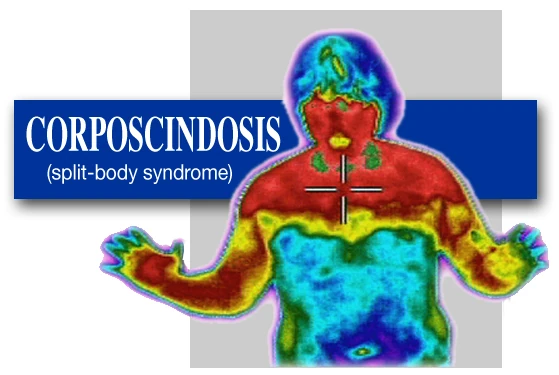 Corposcindosis Wiki | Fandom