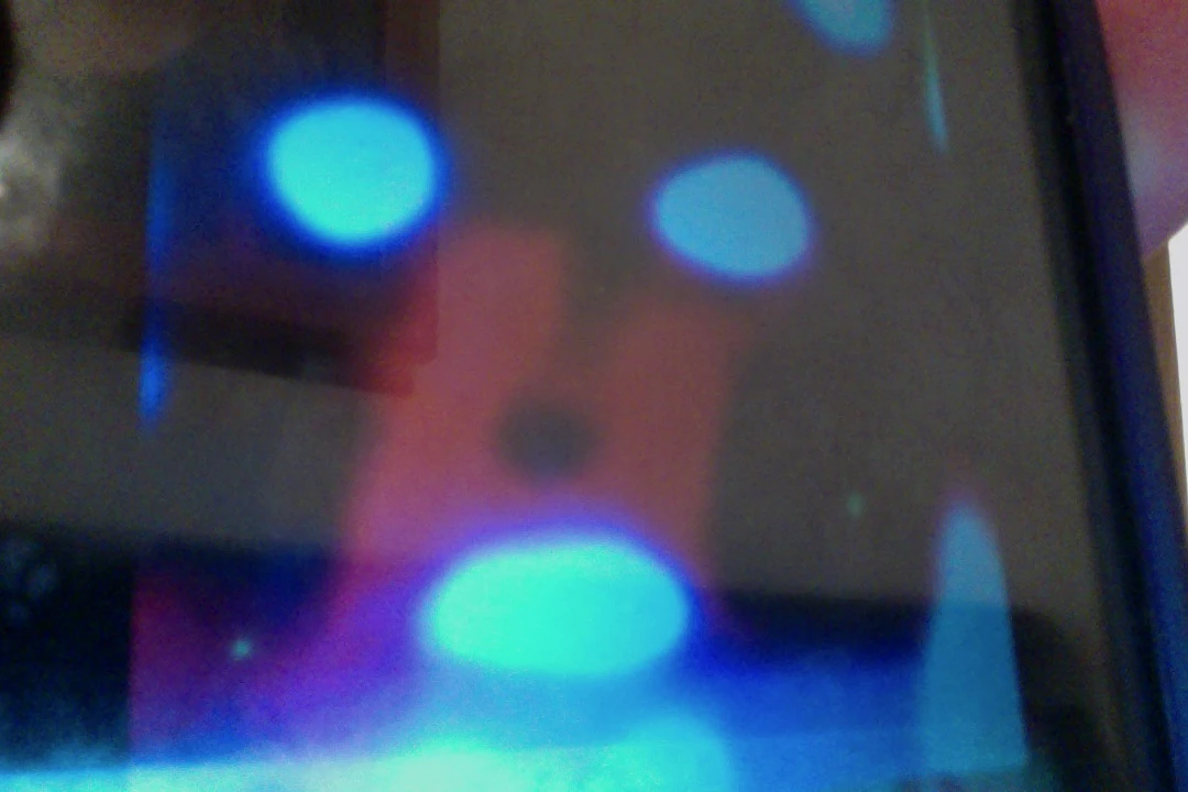 The Skinless Man | CREEPS CASTLE Wikia | Fandom