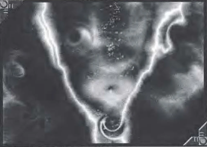 Soulkiller (Vacant) | Cyberpunk Wiki | Fandom