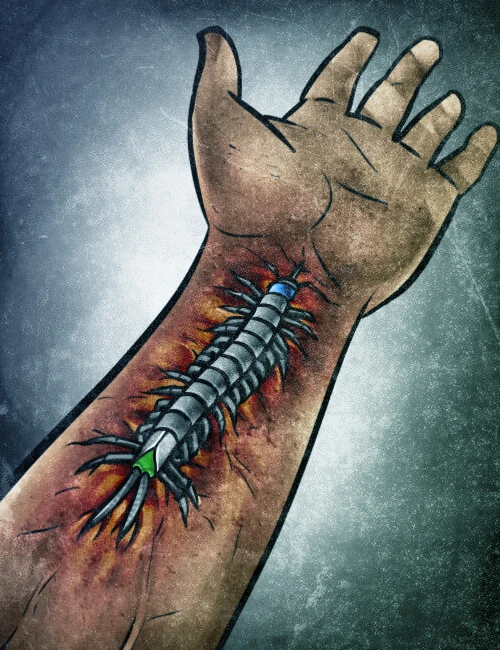 Suture | Cyberpunkdreams Wiki | Fandom