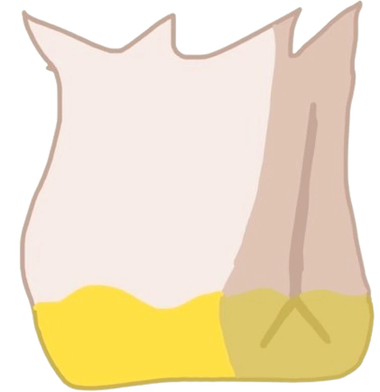 Making low quality recommended characters into high quality: Yolk Bag ...