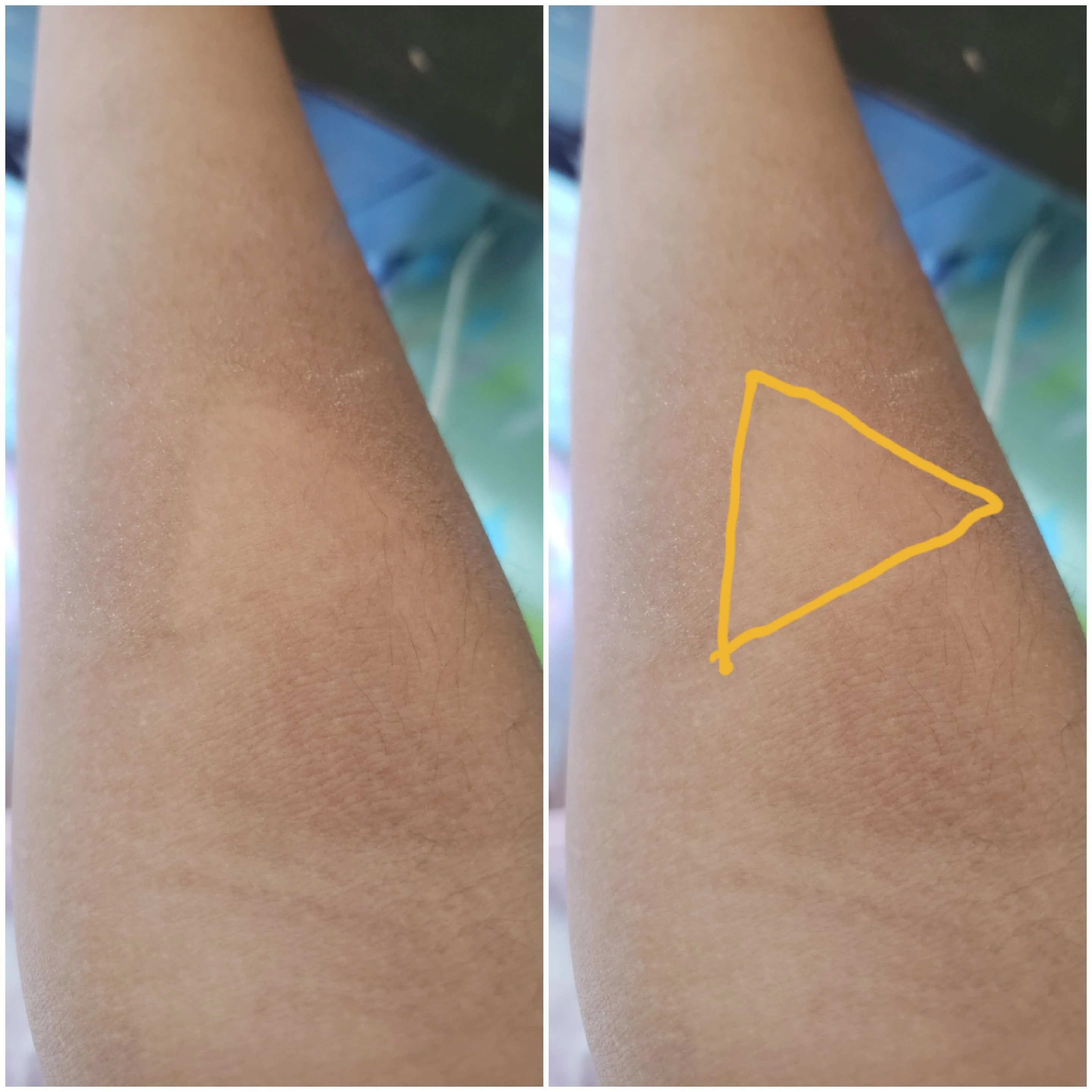 So the other day i realized i had a weird triangle tan mark on my arm ...