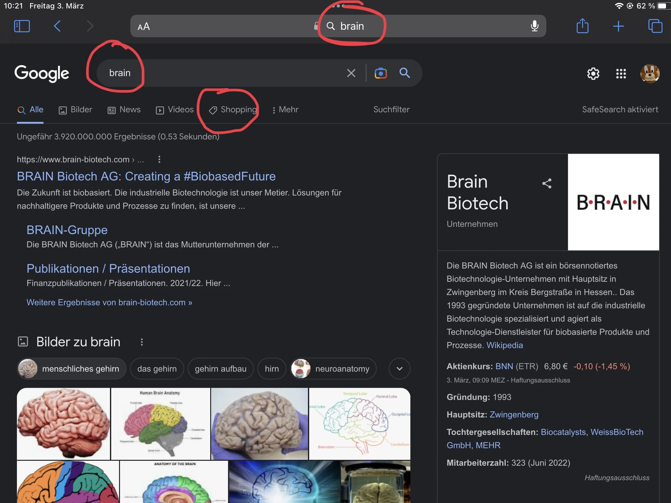 Bro can buy a brain | Fandom