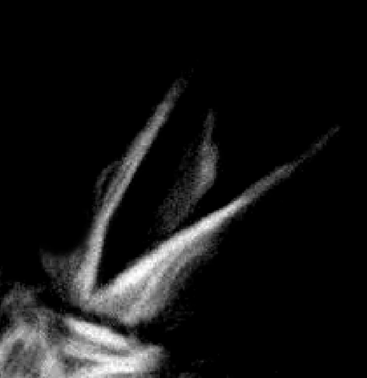 Here is the another 3 Phases for MIBU 250000 Phases. | Fandom