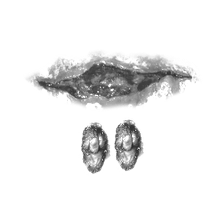 Make your own fleshy face | Fandom