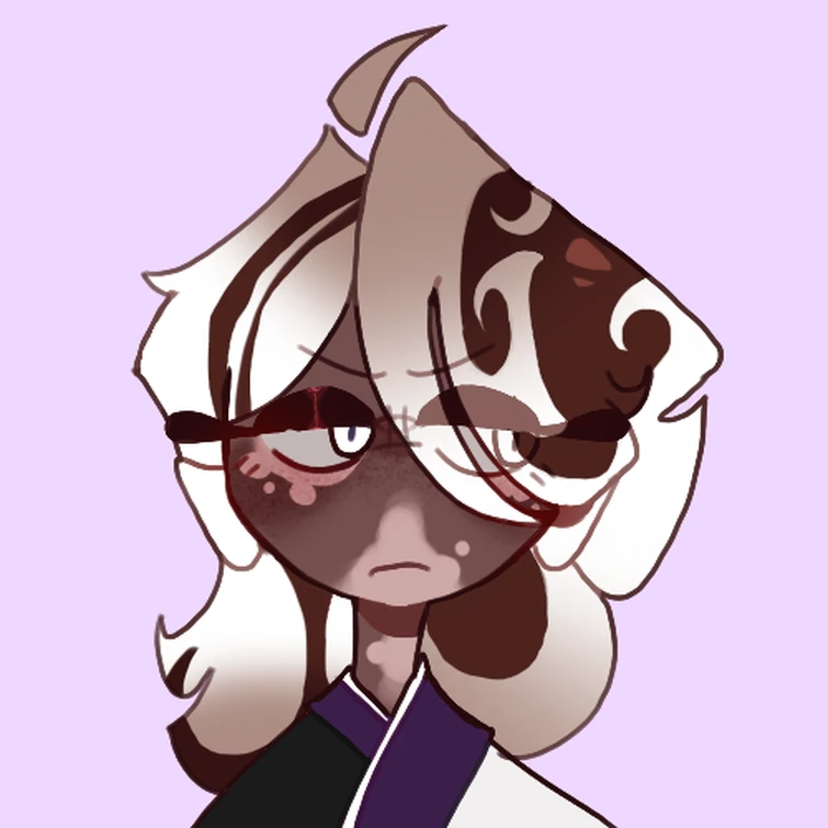 Playing around with,, vitiligo- | Fandom