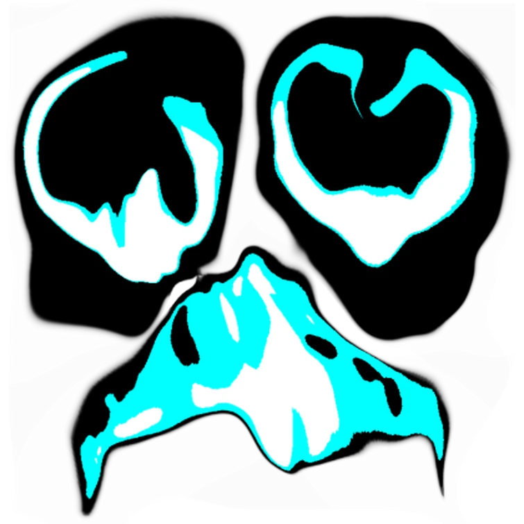 I want real images of climbo Jimbo and Fredrick | Fandom