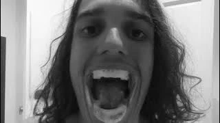 Dennis Brush Teeth | Dennis Wiki | Fandom