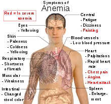 Anemia | Dr. Quinn Medicine Woman Wiki | Fandom