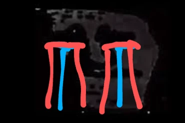 Is the wiki ded | Fandom